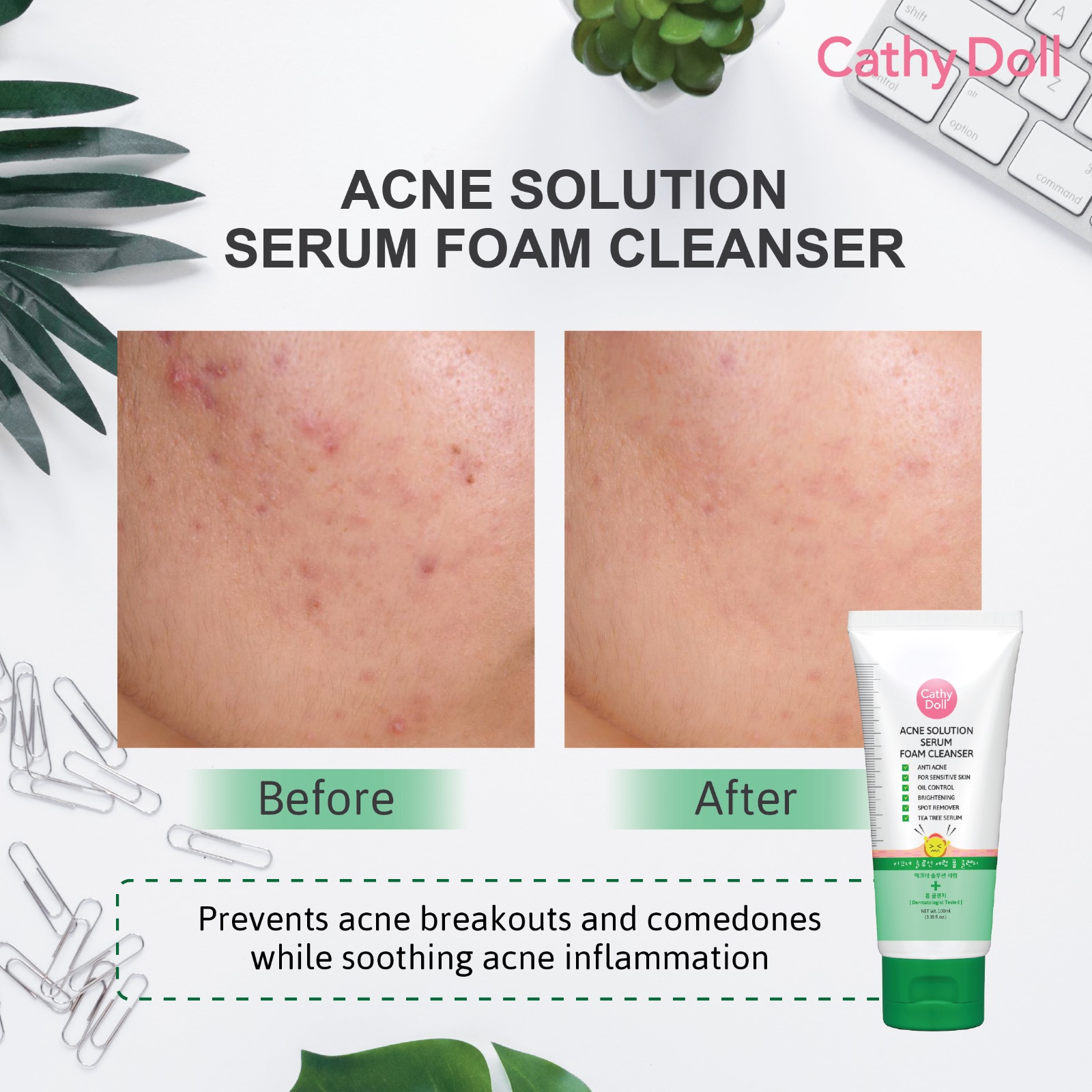 Cathy Doll Acne Solution Serum Foam Cleanser -100ml – Story Brand